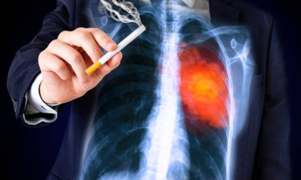 How to Recognize Early Signs of Lung Issues from Vaping